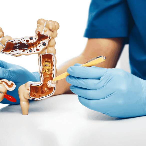 Medicamentos procinéticos: ¿qué son y para qué sirven?