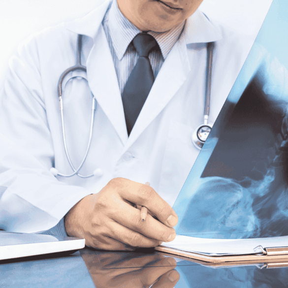 Medicamentos procinéticos: ¿qué son y para qué sirven?